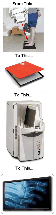 CR - Computed Radiography